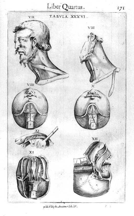 History – Aaron's Tracheostomy Page