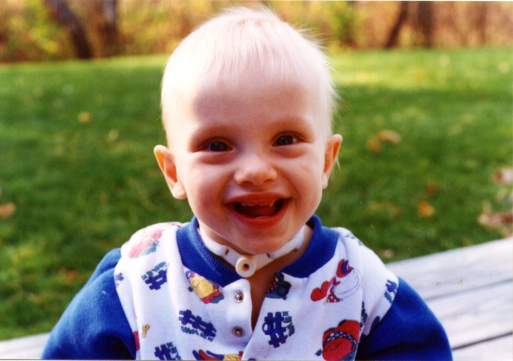 Aaron's Tracheostomy Page – The Internets leading tracheostomy resource ...